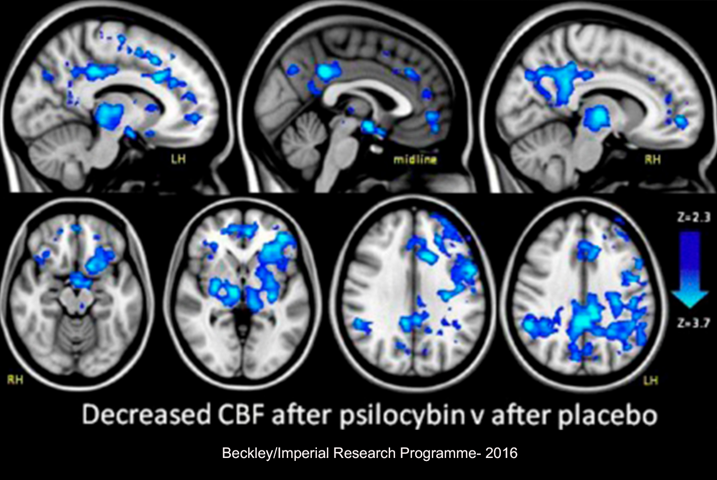 Neural correlates of the psychedelic state as determined by fMRI ...